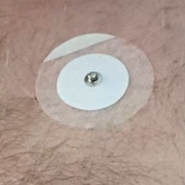 ECG Electrode Pads – Comfort Release